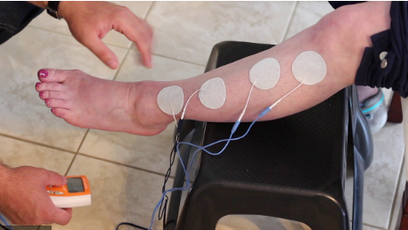 What Is The Effect Of Neuromuscular Electrical Nerve Stimulation In The ...
