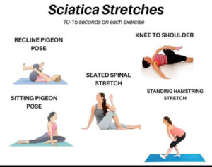 Physiolair/sciatica And Sciatic Nerve Compression
